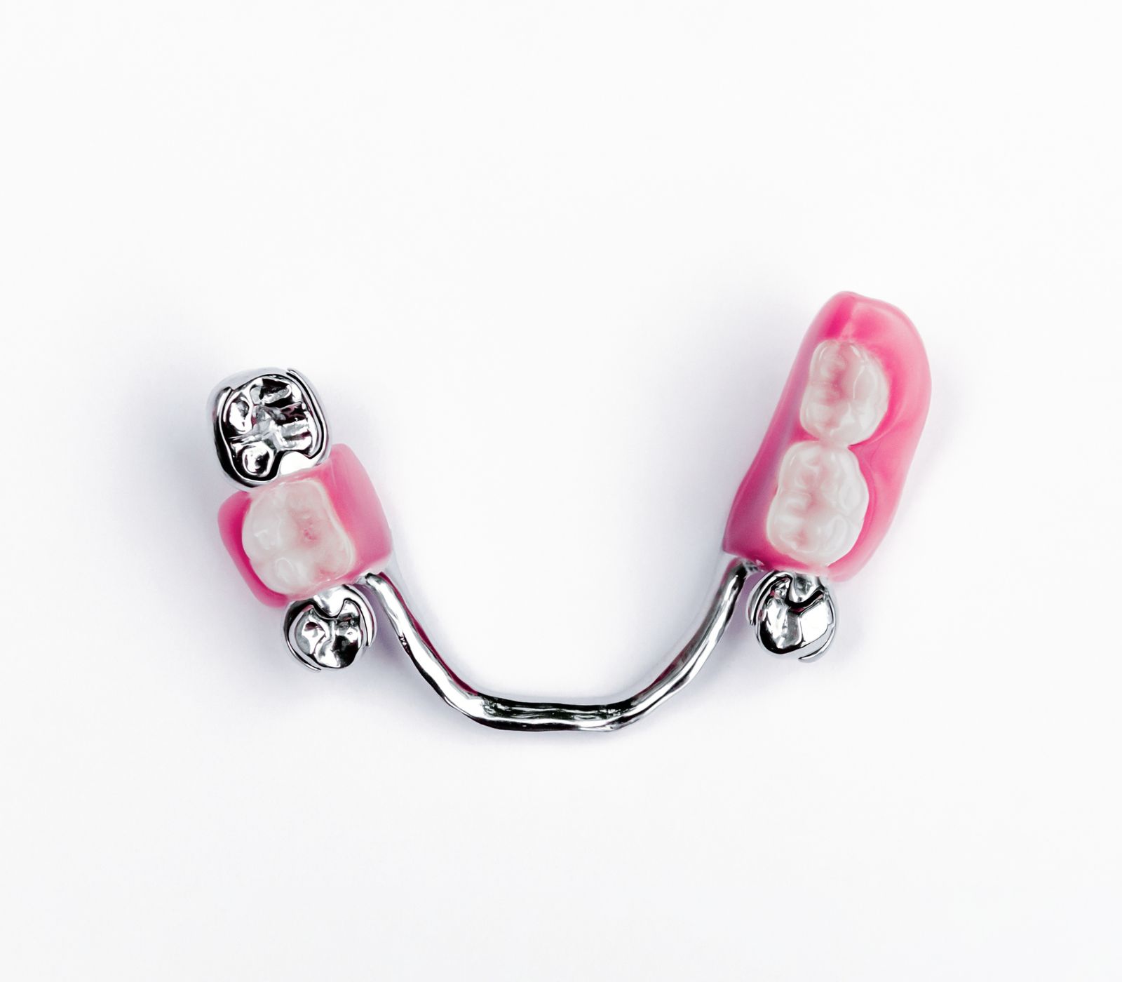 Prothèse dentaire Amovible Limoges - Chirurgien dentiste Limoges